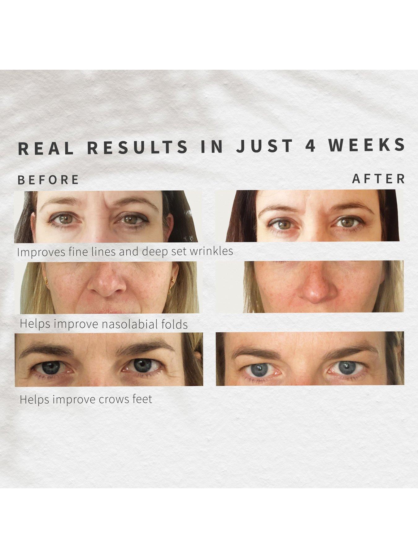 Sensse Professional LED Mask | very.co.uk